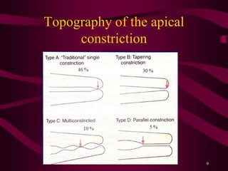 working length estimation in endodontic | PPTX