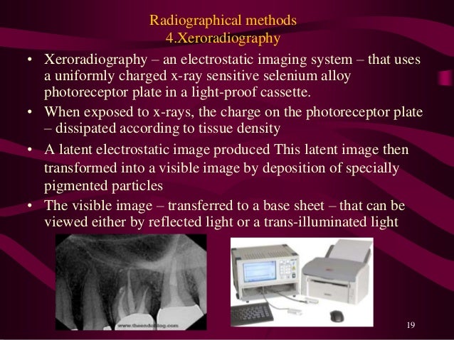 working length estimation in endodontic