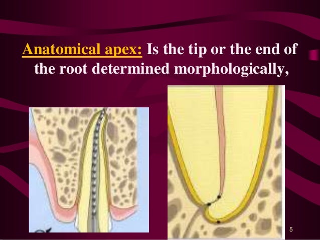 working length estimation in endodontic