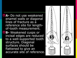 Endometrics root canal working length determination | PPT