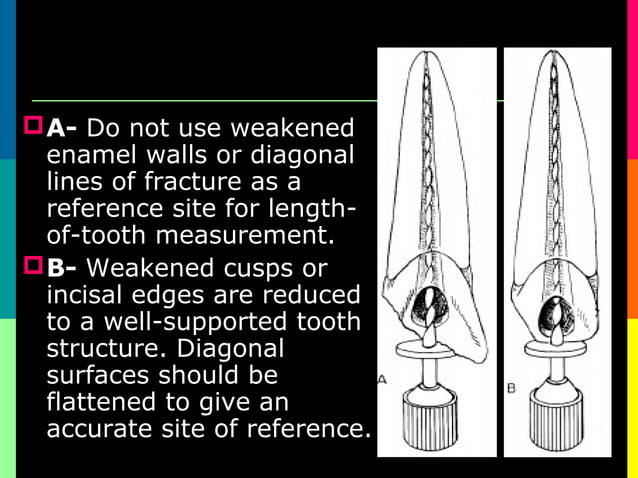 Endometrics Root Canal Working Length Determination Ppt Dental Health Diseases And Conditions