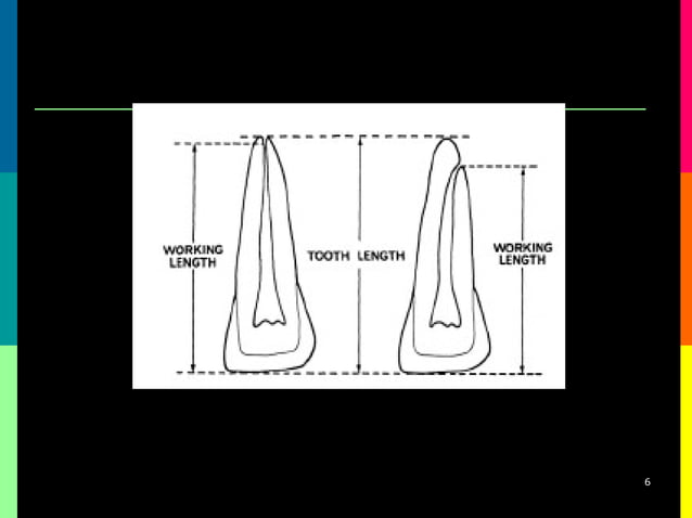 Endometrics Root Canal Working Length Determination Ppt Dental Health Diseases And Conditions