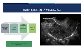Endometrio imagenologia .pptx........... | PPTX