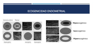 Endometrio imagenologia .pptx........... | PPTX