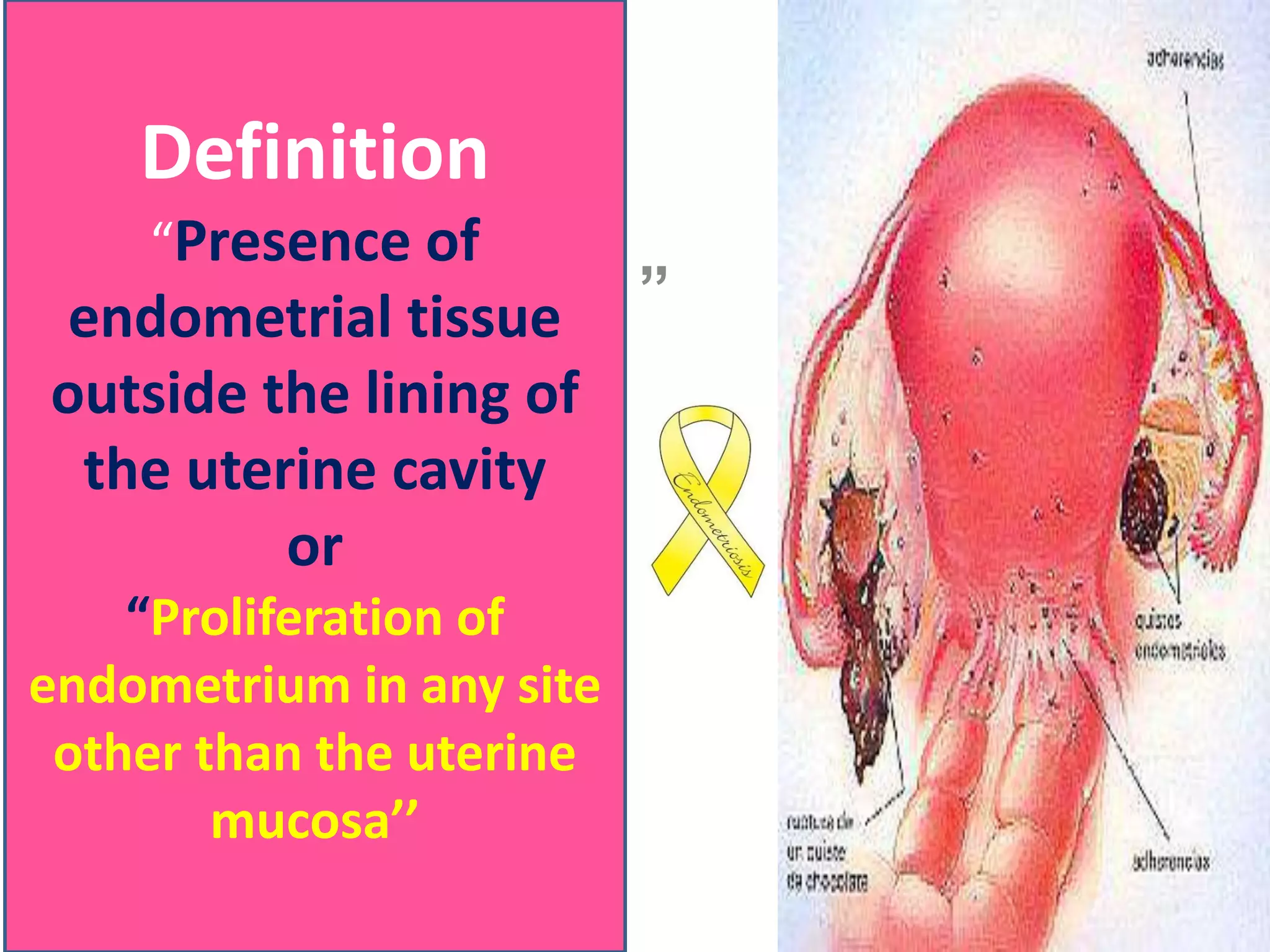 ENDOMETRIOSIS:THE PROBLEM STATEMENT: Dr. Sharda Jain,Life care cente | PPTX
