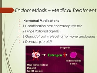 Endometriosis | PPT