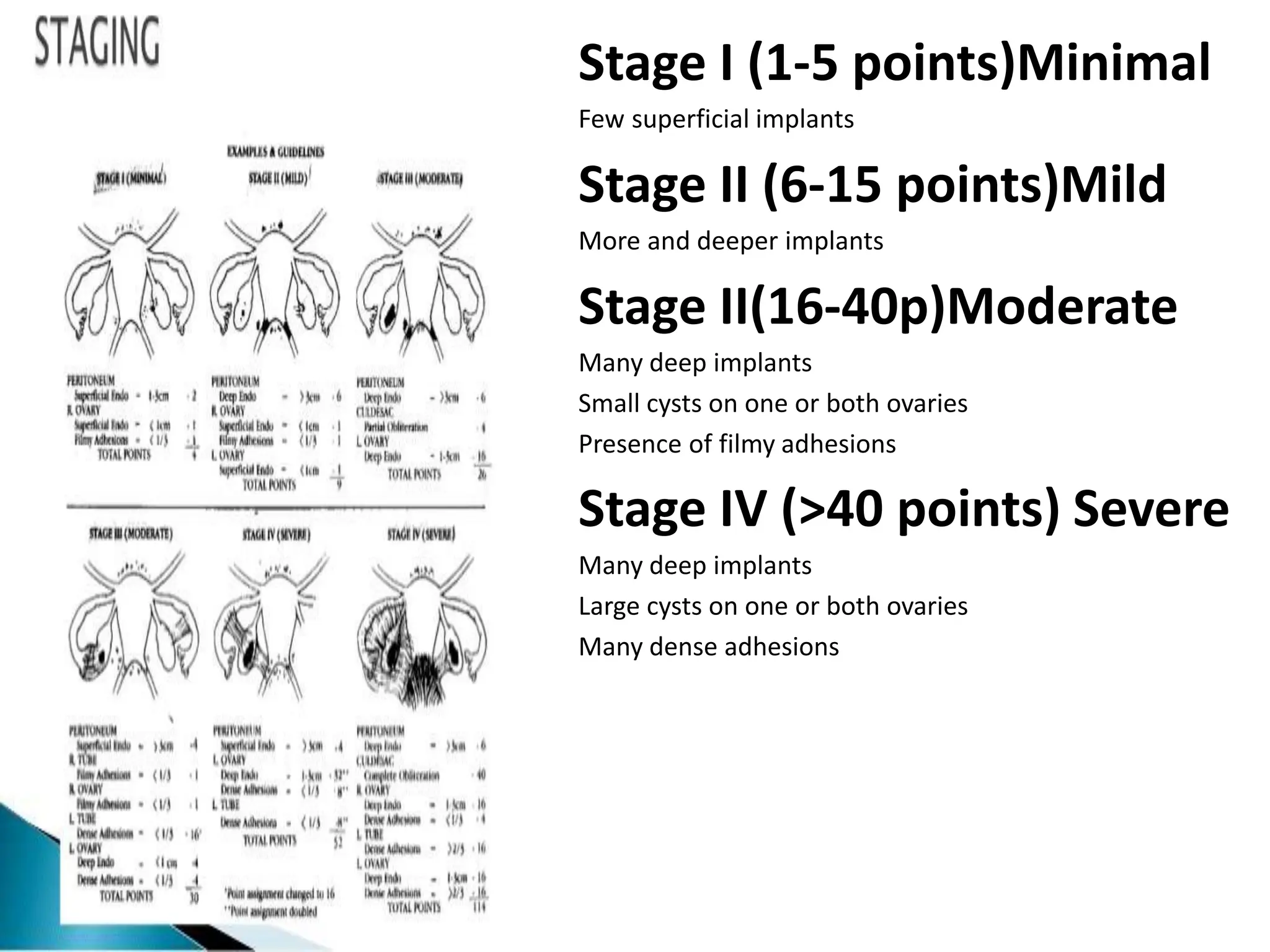 classification of endometriosis/staging/management | PPTX