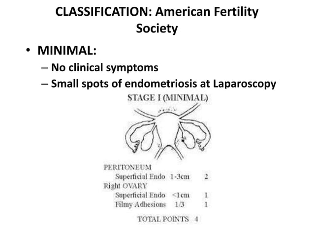 classification of endometriosis/staging/management | PPTX