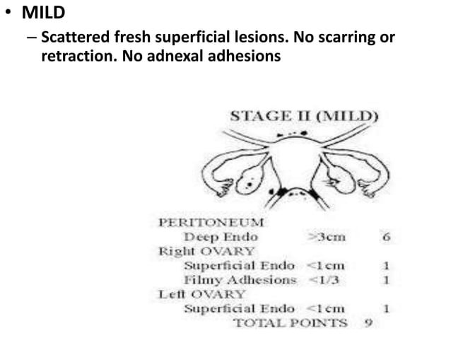 classification of endometriosis/staging/management | PPTX