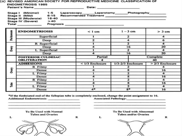 classification of endometriosis/staging/management | PPTX
