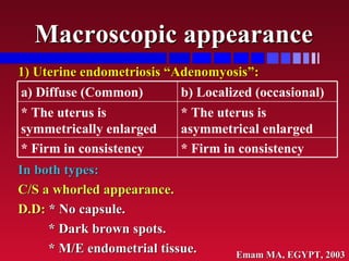 endometriosis | PPT