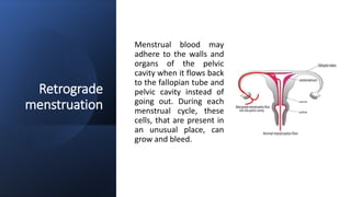 Endometriosis causes.pptx