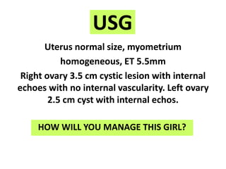 Endometriosis – Changing Perspective - Case based approach | PPTX