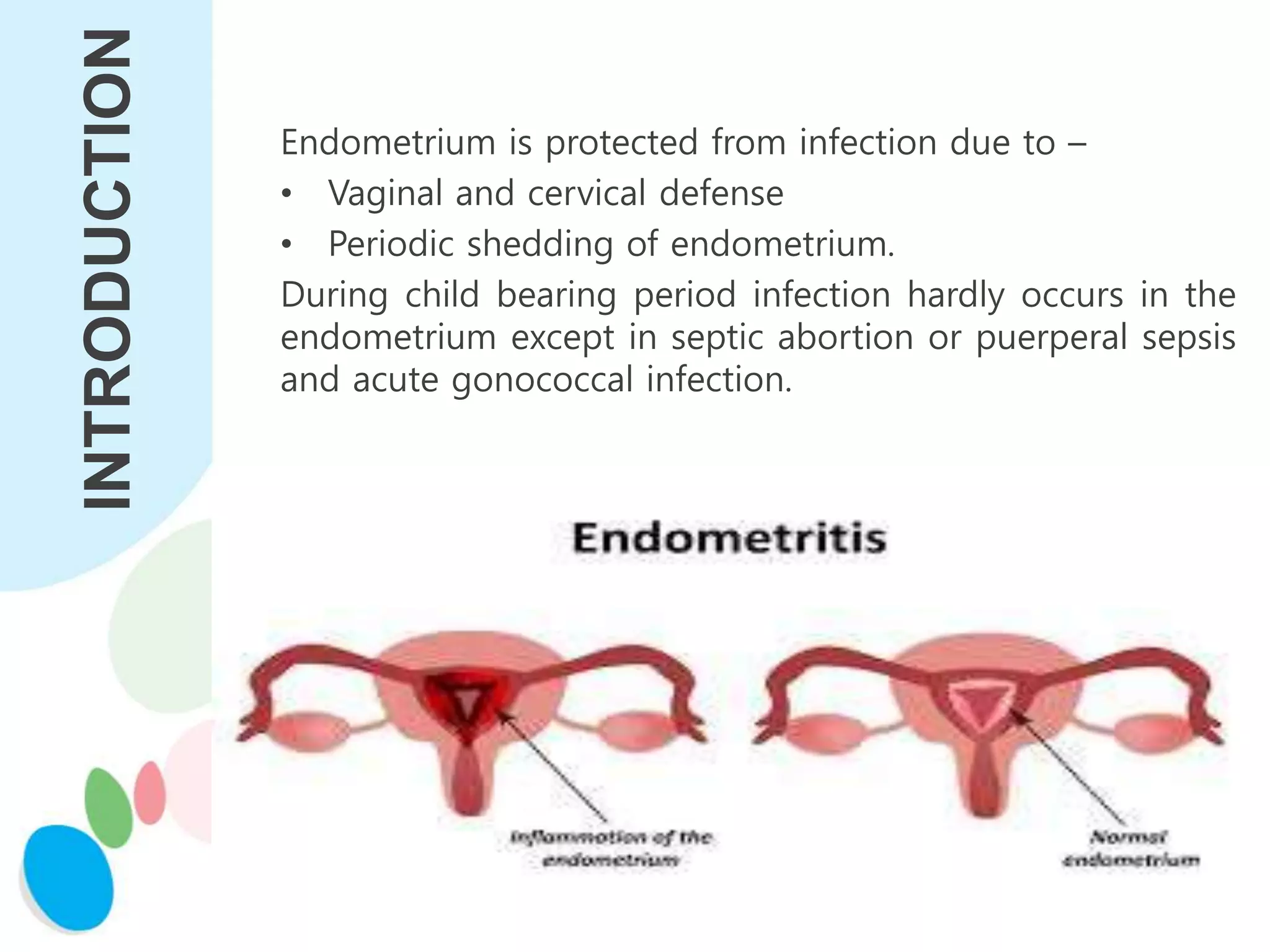 Endometritis | PPTX