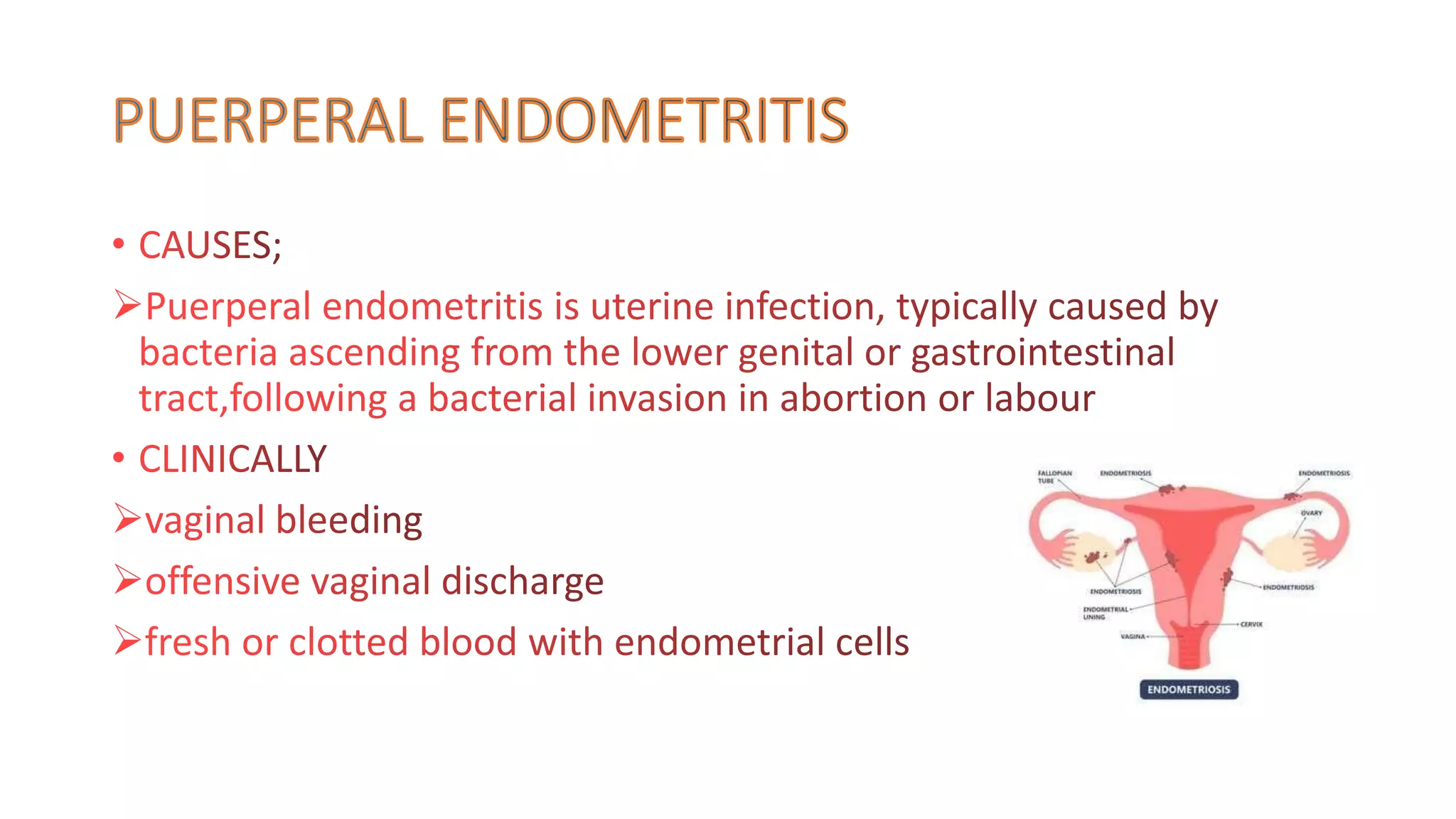 ENDOMETRITIS obstetric and gynecology . | PPTX
