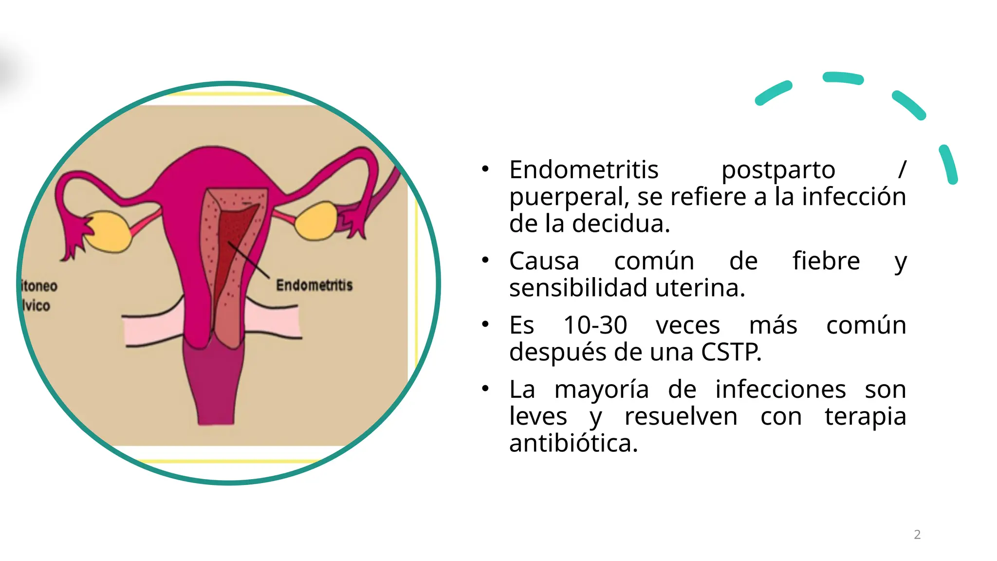ENDOMETRITIS POSTPARTO A partir del puerperio | PPT