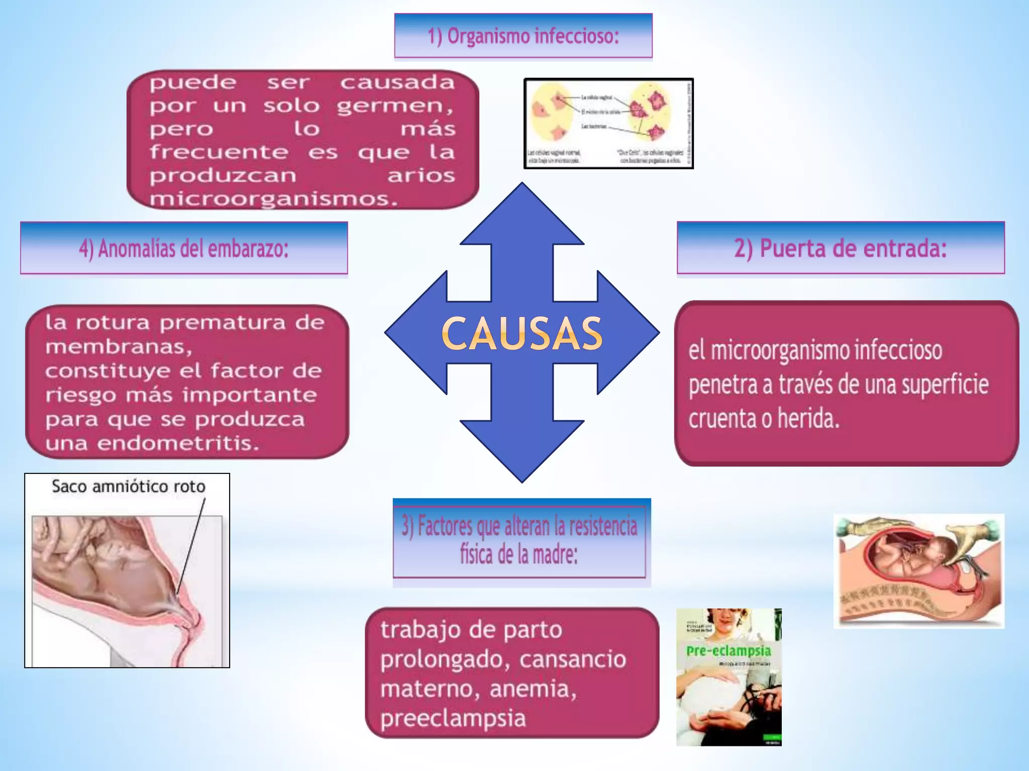 Endometritis puerperal | PPTX