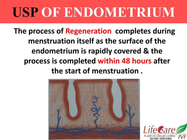 Thin Endometrium & Infertility (Part – I) , Dr. Sharda Jain , Life Care ...