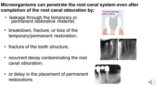 Endo microbiology bm | PPTX | Dental Health | Diseases and Conditions