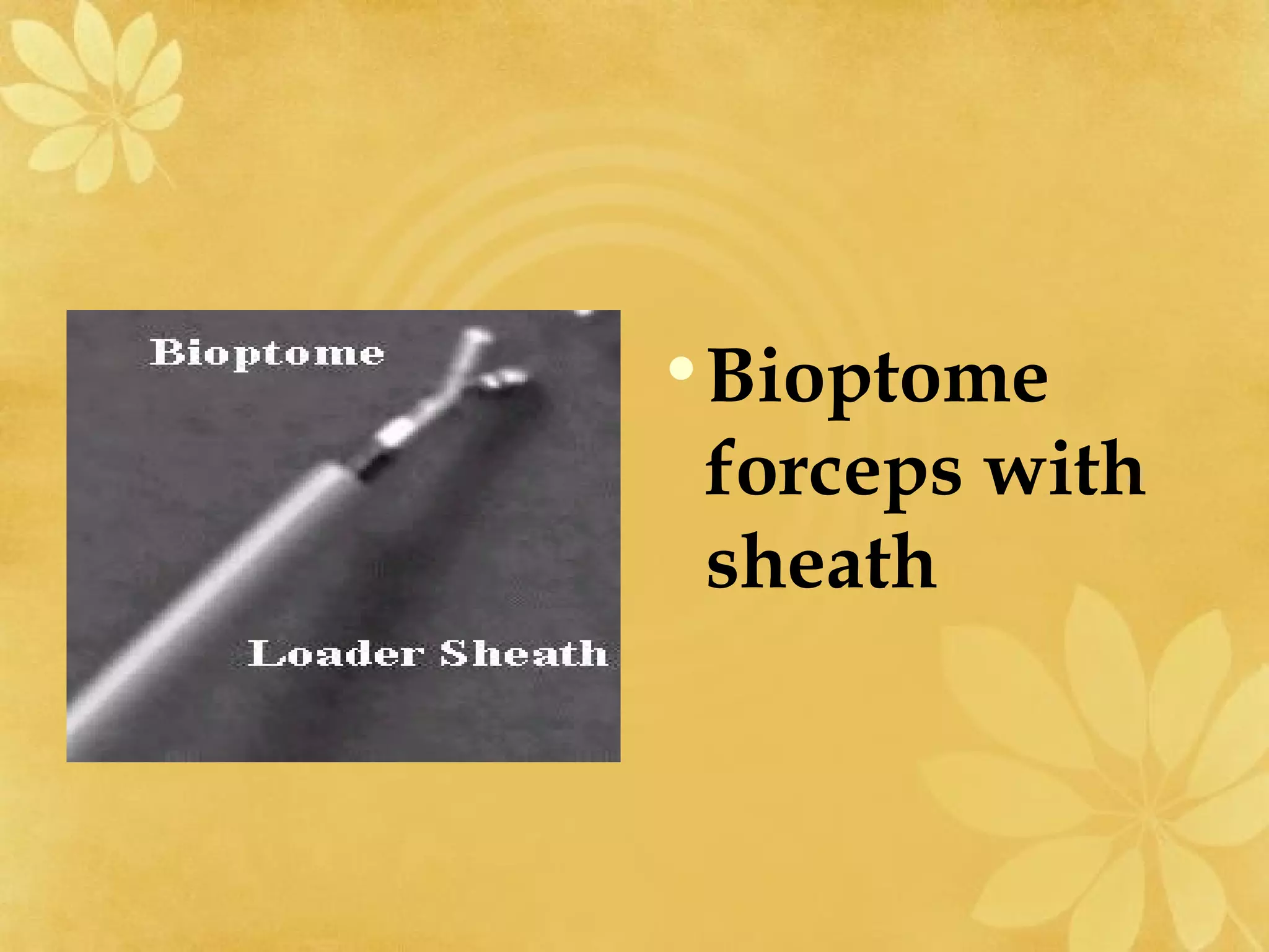 Endomyocardial biopsy | PPT