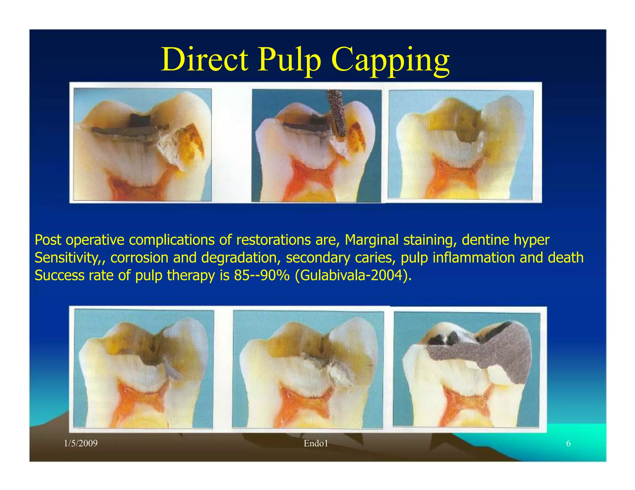 Endo note 1 definition and history | PPTX