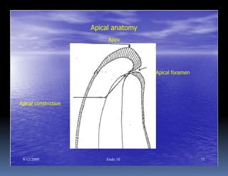 Endo note 10 preparation of straight canal | PPTX