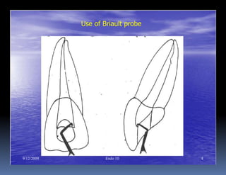 Endo note 10 preparation of straight canal | PPTX