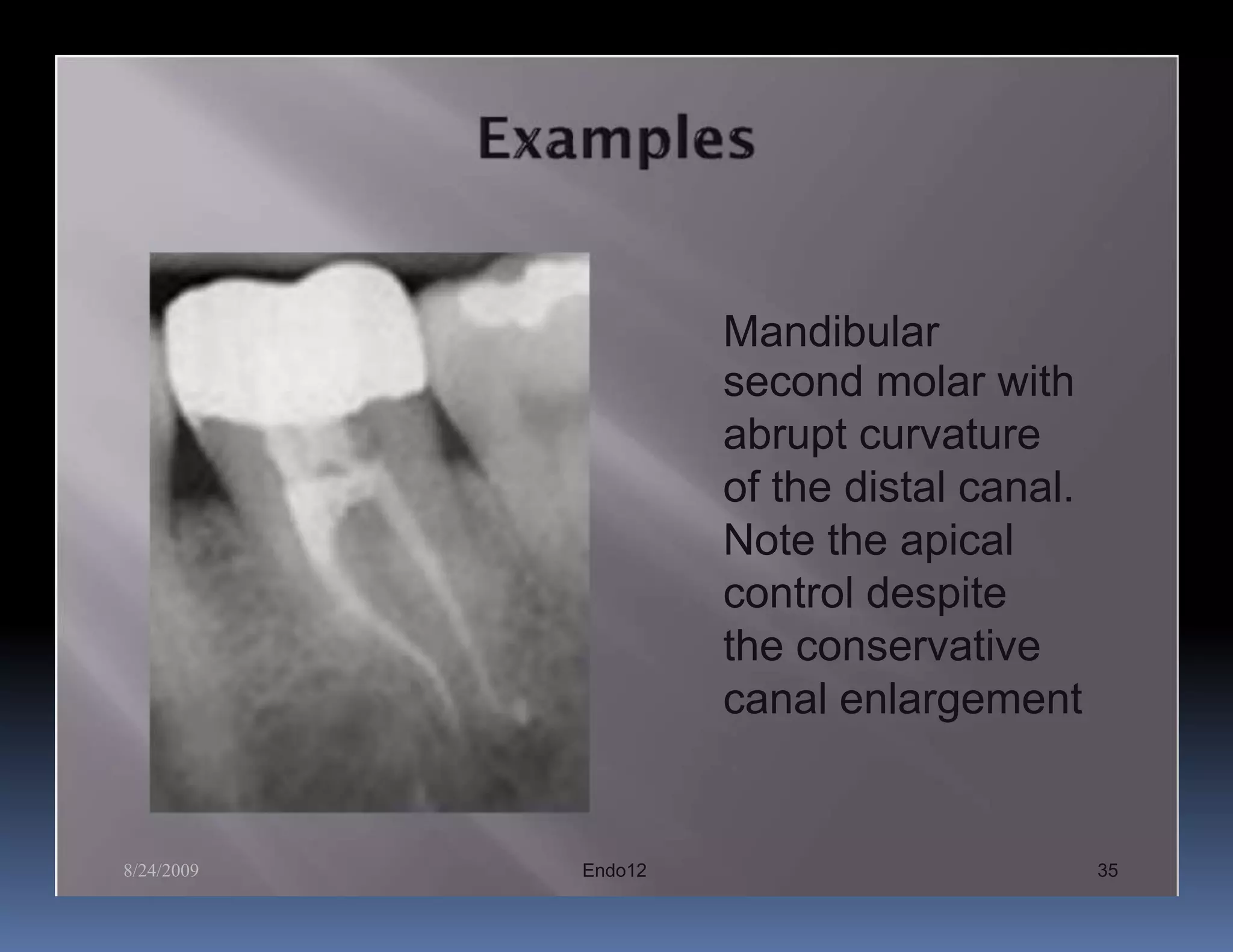 Endo note 12 rotary technique | PPTX | Science