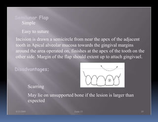 Endo note 15 surgical endodoic | PPT