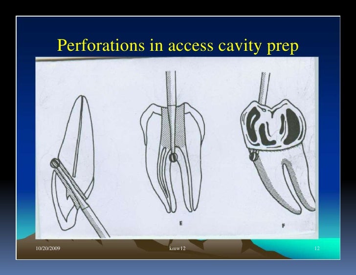 Endo note 17 problem solving in endodontics