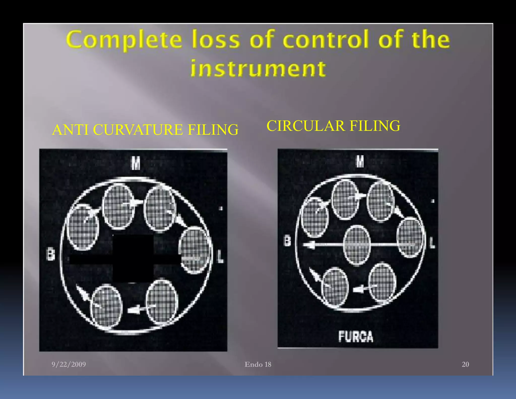 Endo note 18 ledge formation | PPTX