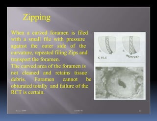 Endo note 18 ledge formation | PPTX