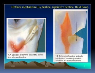 Endo note 2 iintroduction | PPTX