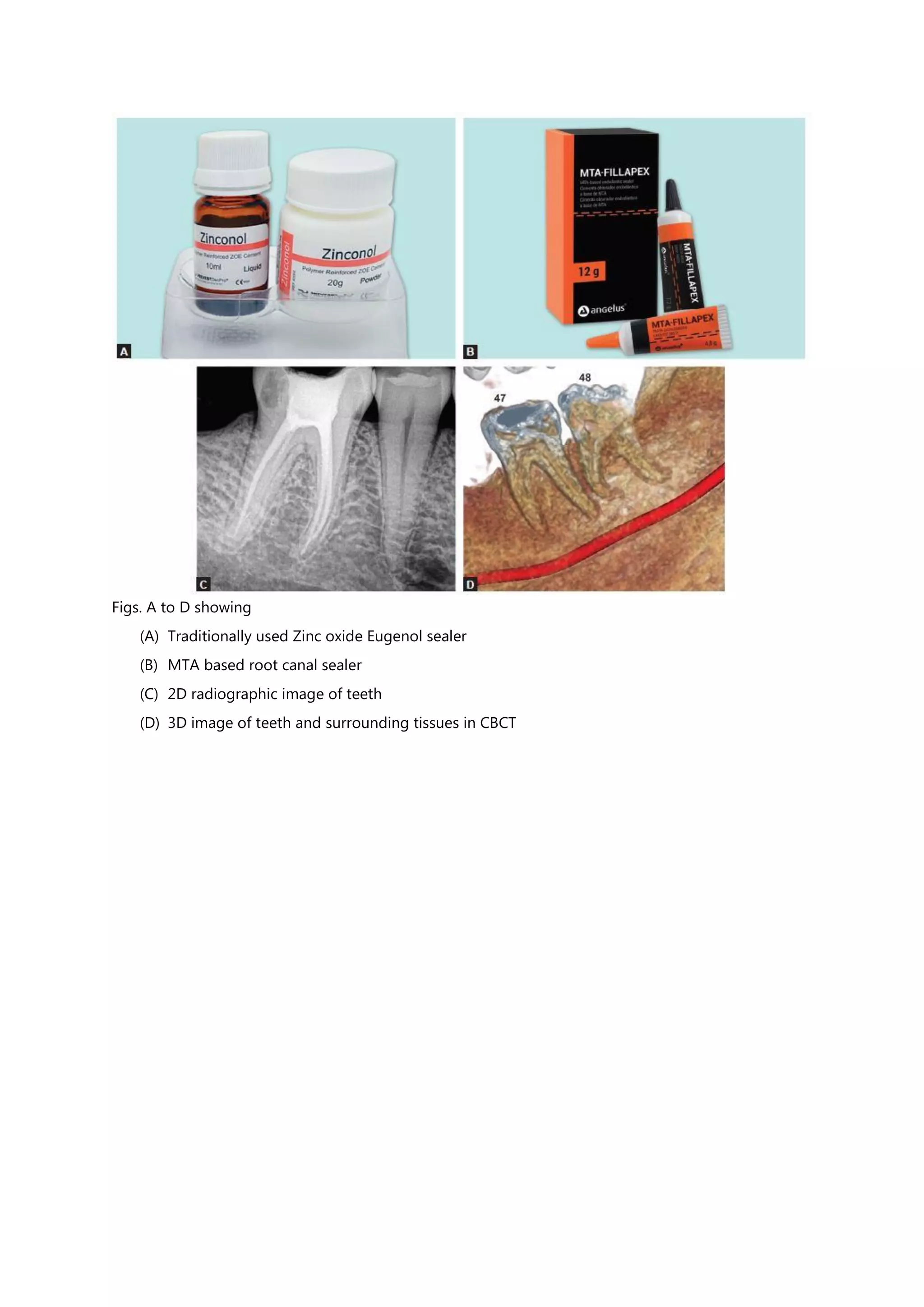 Endo notes (revised18) | PDF