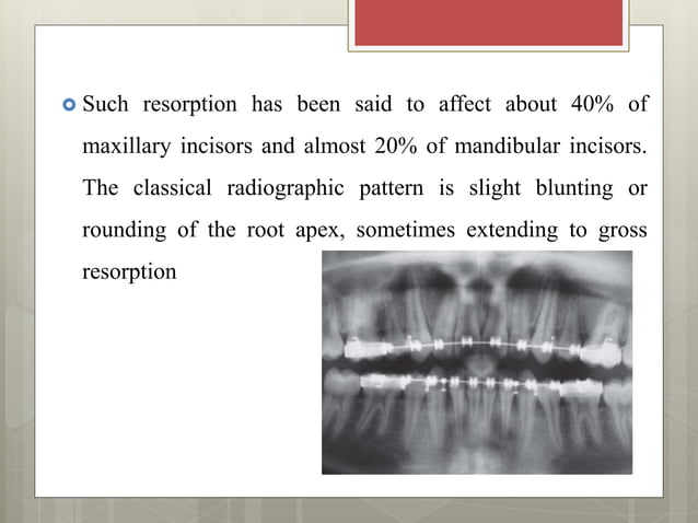 Endo ortho interface by DR. JAGADEESH KODITYALA | PPTX