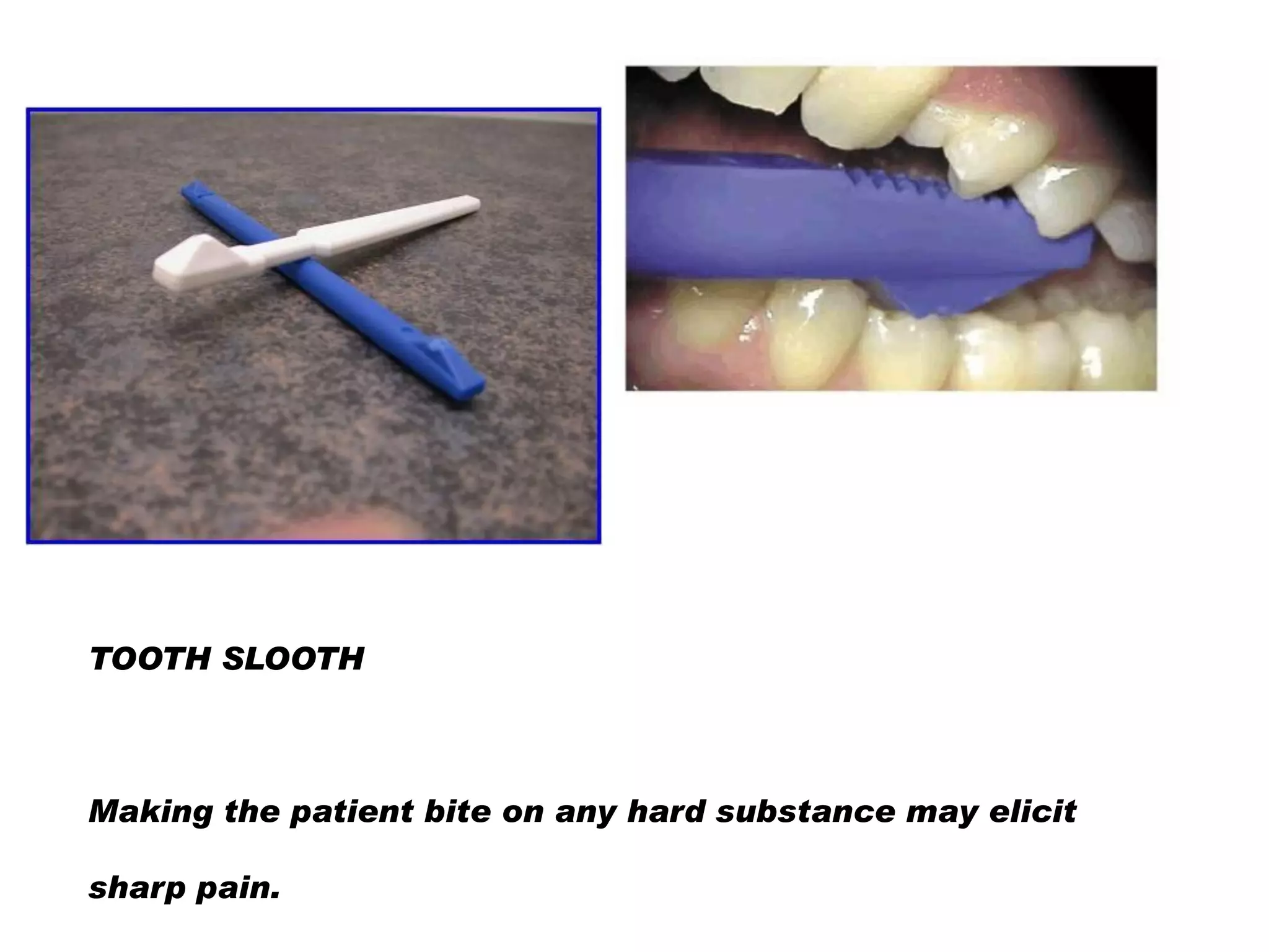 Endodontic Pain | PDF