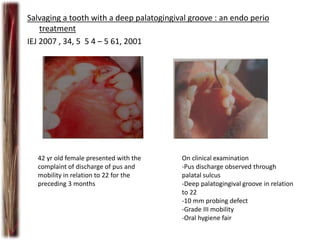 endo perio.pptx