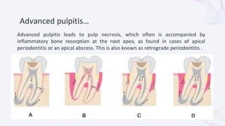 endo perio w33333333333333333333(2).pptx