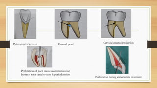 Endodontic Periodontic Lesions copy.pptx