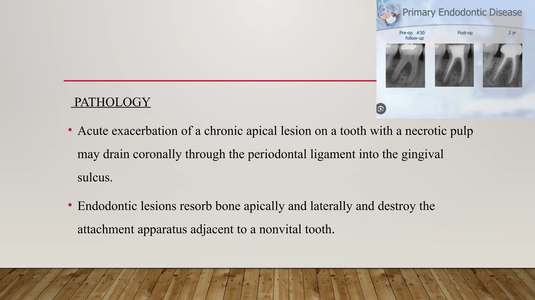 ENDO PERIO LESION part 2............pptx