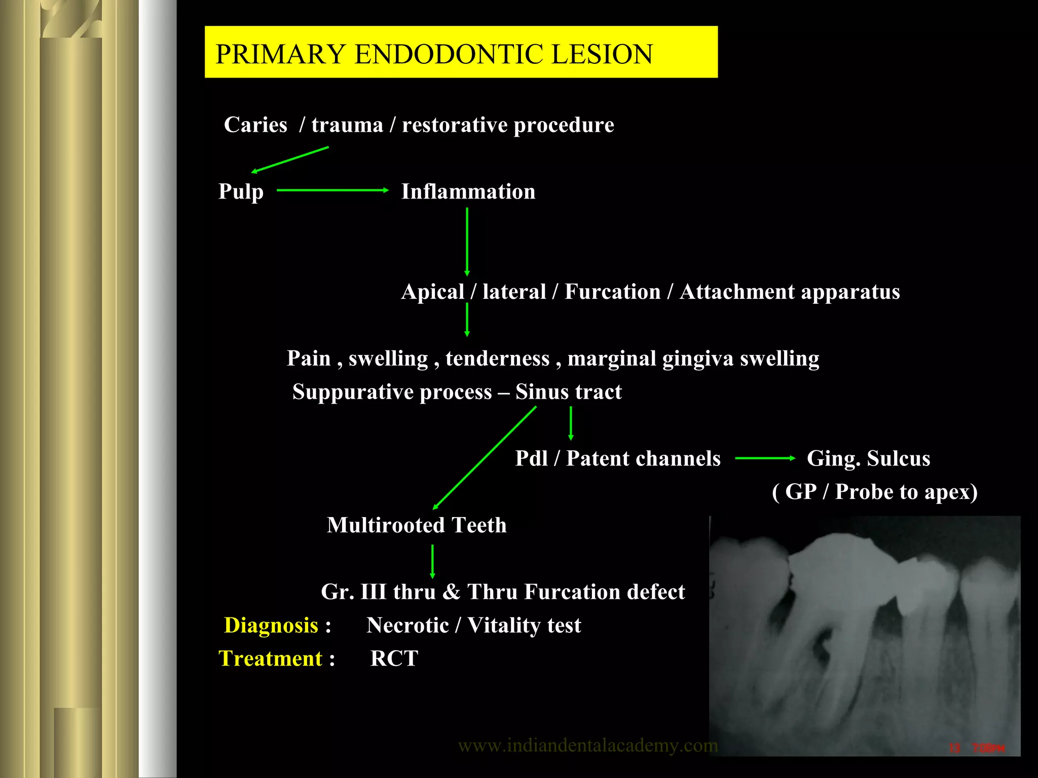 Endo perio lesions /certified fixed orthodontic courses by Indian ...