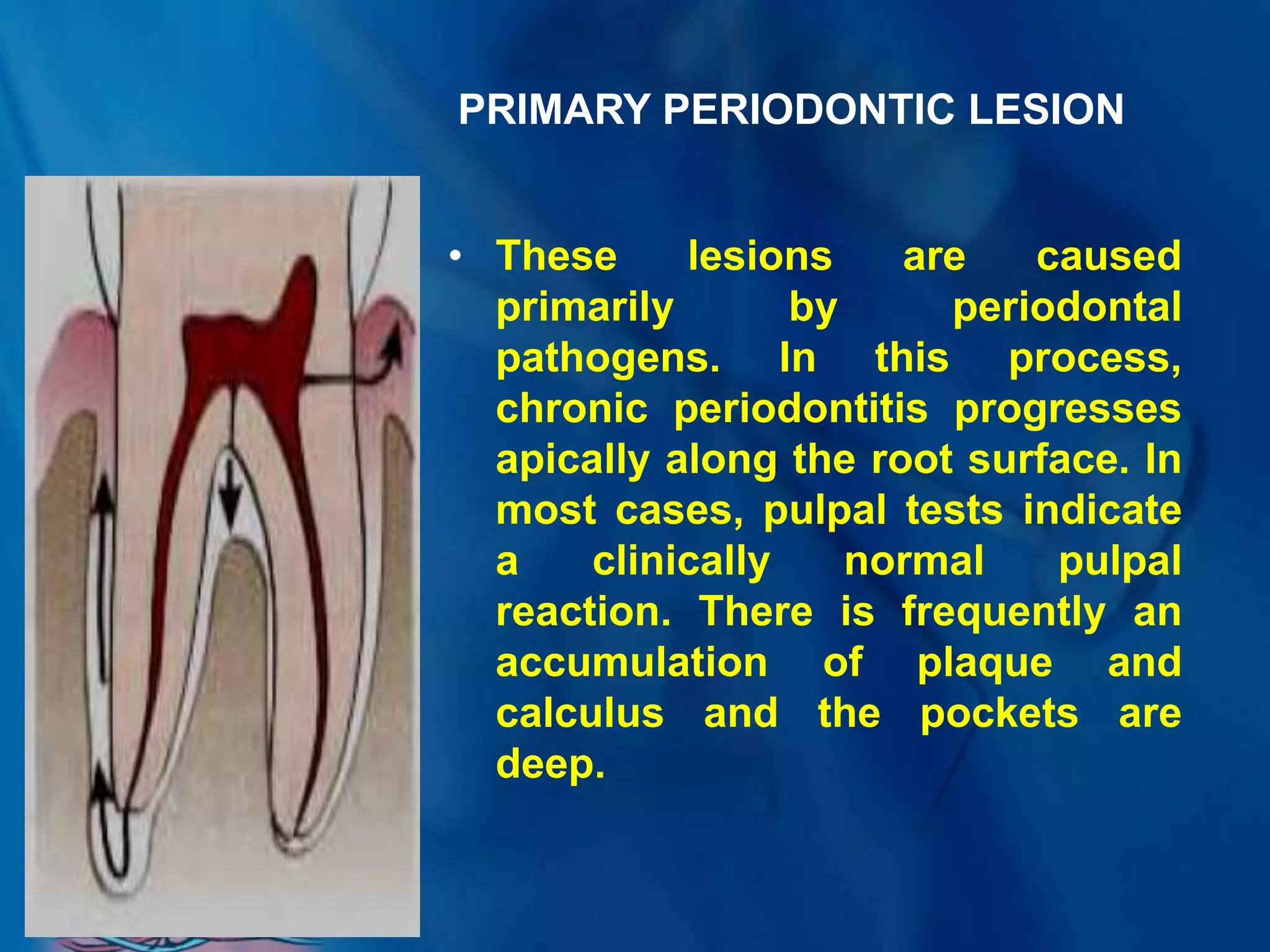 Endo – Perio lesions.ppt