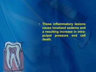 Endo – Perio lesions.ppt