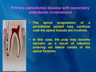 Endo – Perio lesions.ppt