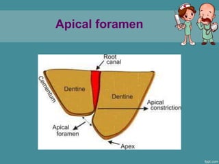 Endo-Perio.ppt