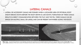 Endo perio relation | PDF