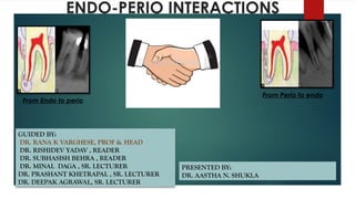 endo perio relationship in prosthodontic | PPTX