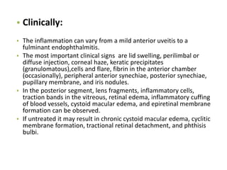 EndophTHALMITIS MANAGEMENT -AJAY DUDANI | PPTX