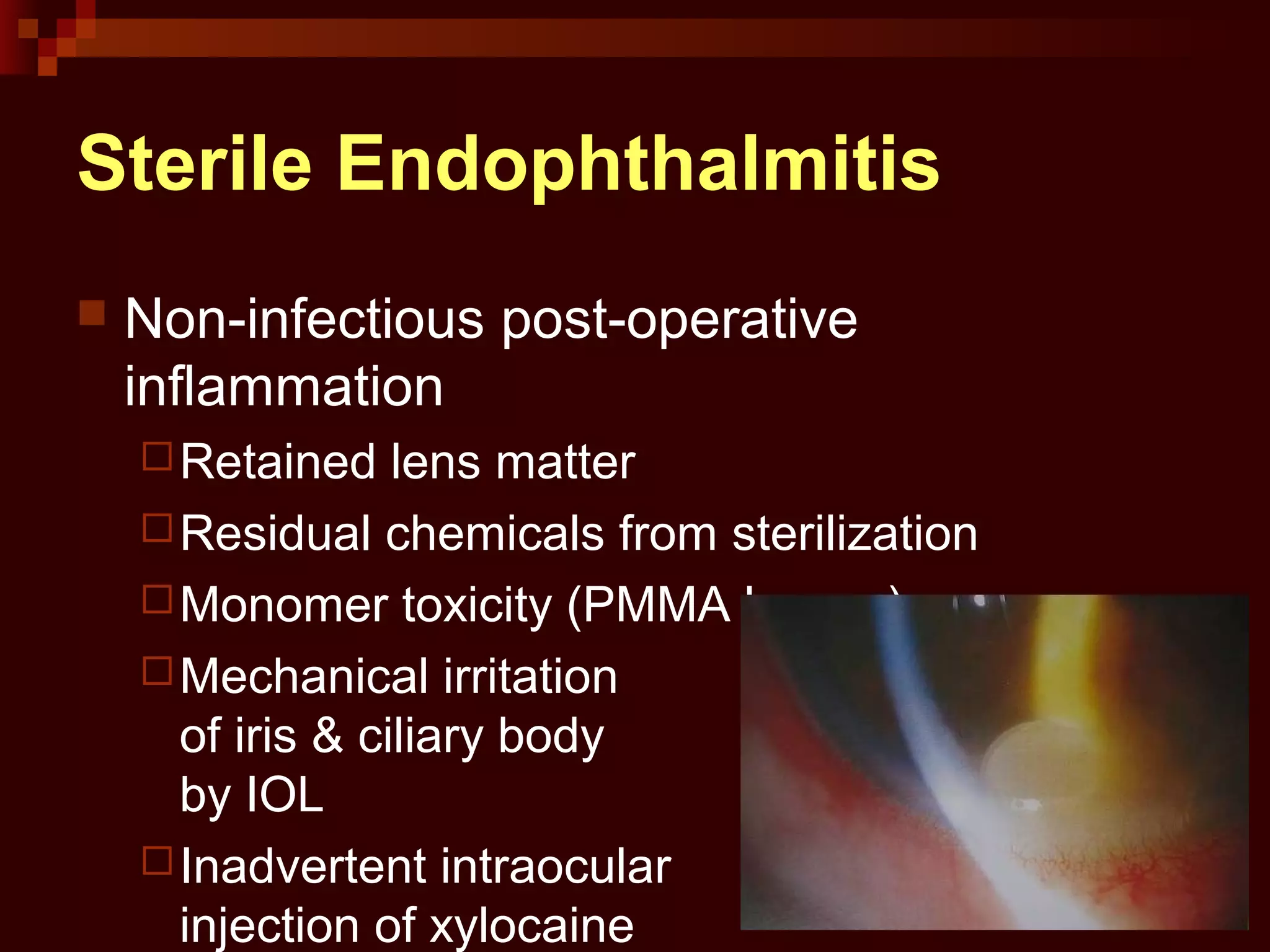 Endophthalmitis | PPT