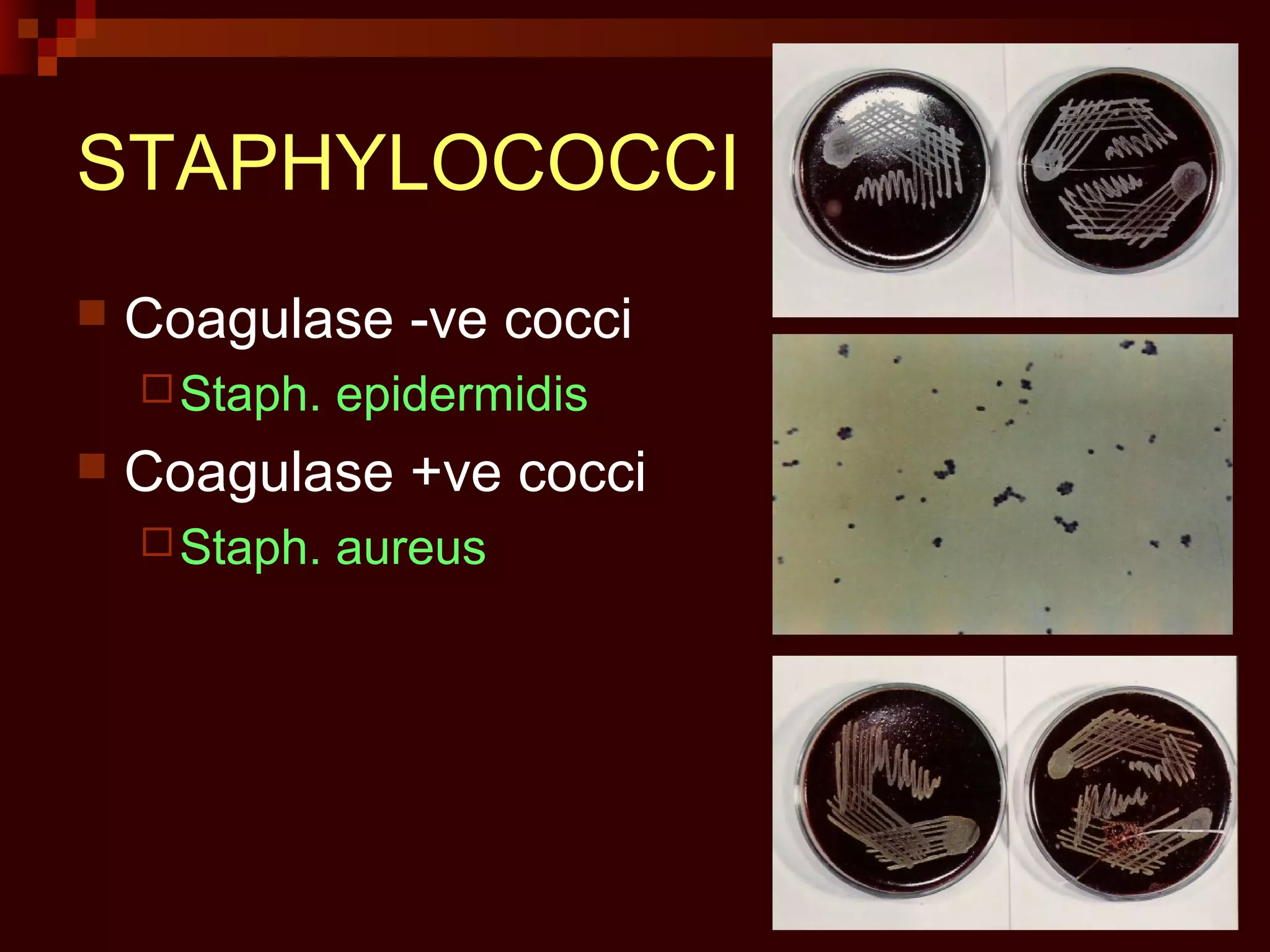 Endophthalmitis | PPT